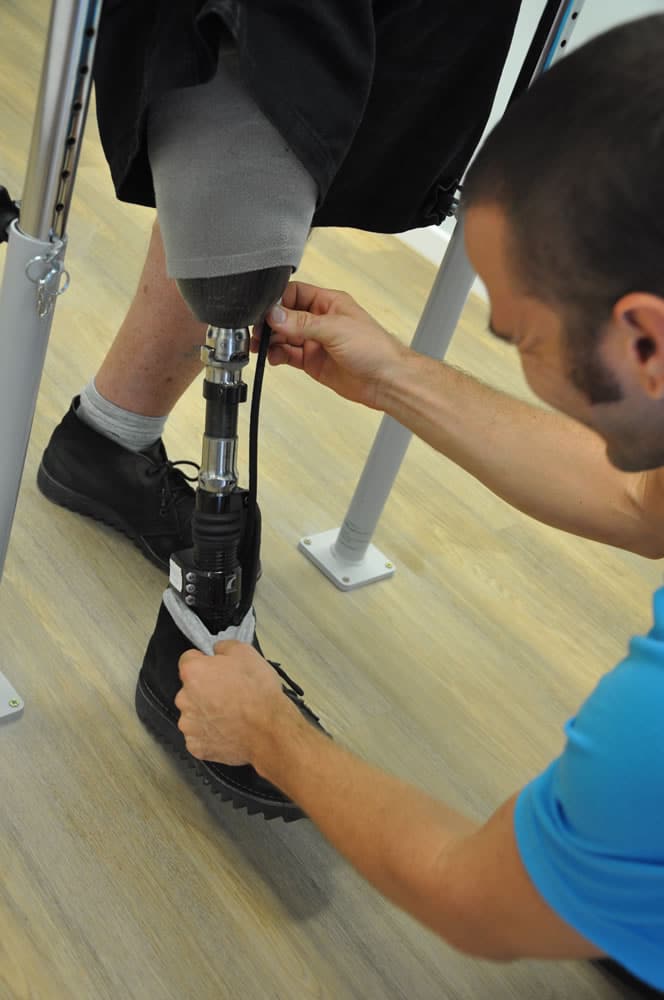 Prosthetic Services in Cairns | Freedom Prosthetics
