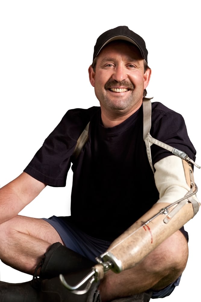 About Us | Freedom Prosthetics